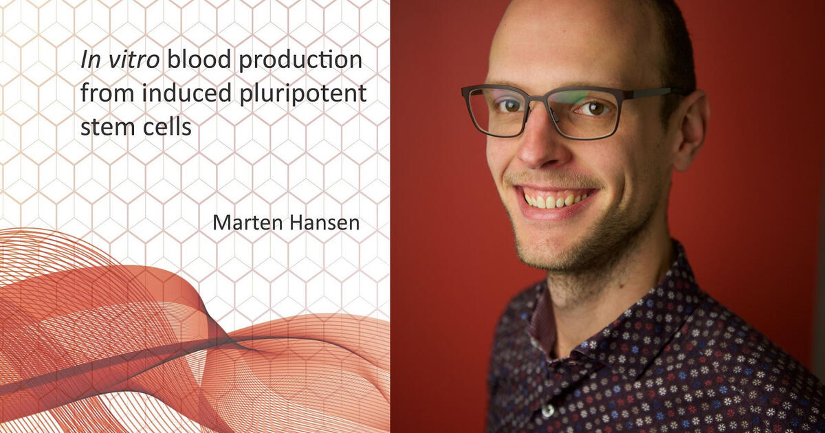 In vitro blood production from induced pluripotent stem cells | Sanquin